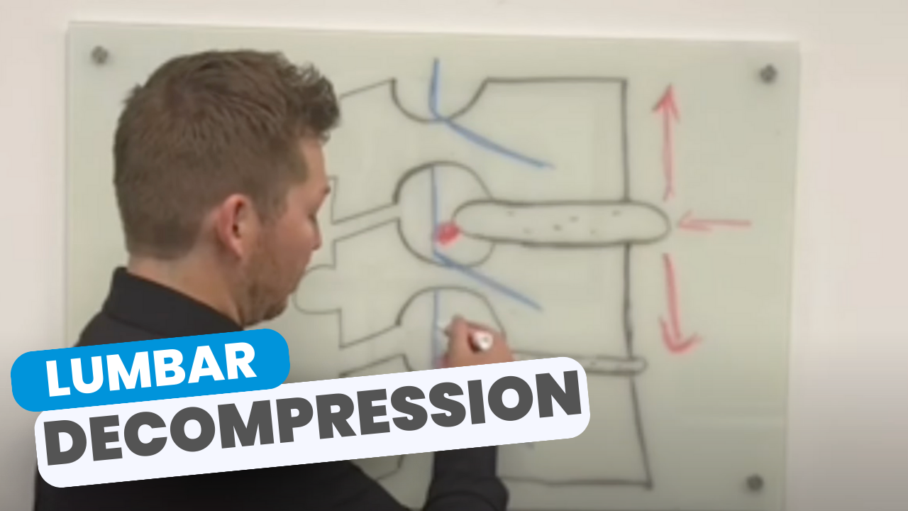 Lumbar Decompression - Optimal Chiropractic